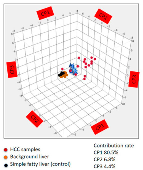Accumulation of Genetic and Epigenetic Alterations in the Background ...