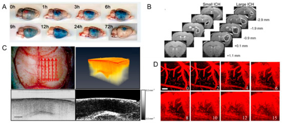 Translational Stroke Research Review: Using the Mouse to Model Human ...