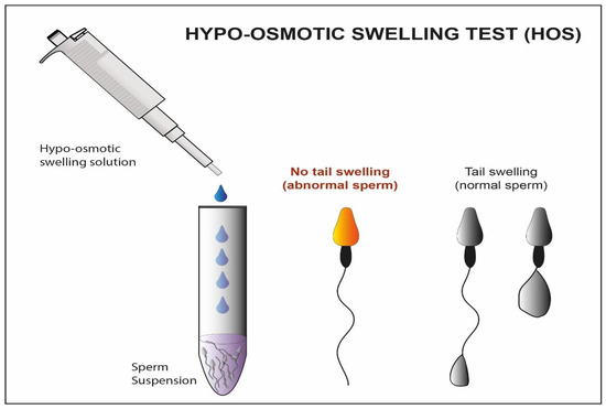 Sperm Selection for ICSI: Do We Have a Winner?
