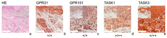 Expression of Proton-Sensitive GPR31, GPR151, TASK1 and TASK3 in Common ...