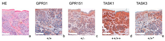 Expression of Proton-Sensitive GPR31, GPR151, TASK1 and TASK3 in Common ...
