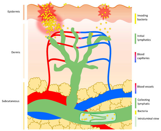 Bacterial Lymphatic Metastasis in Infection and Immunity