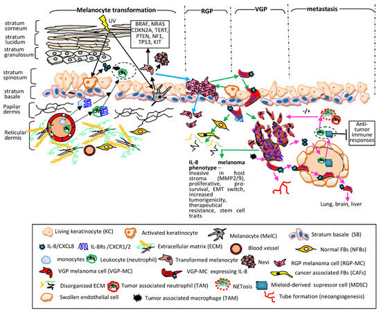 Interleukin-8 in Melanoma Pathogenesis, Prognosis and Therapy—An ...