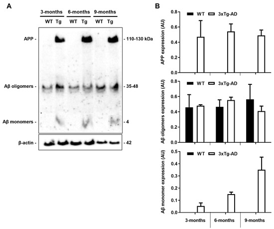 Cells | Free Full-Text | Differences in Immune-Related Genes Underlie ...