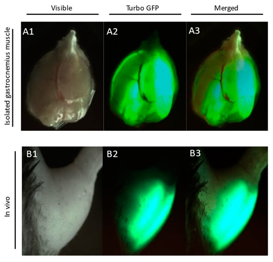 CerS1 but Not CerS5 Gene Silencing, Improves Insulin Sensitivity and ...