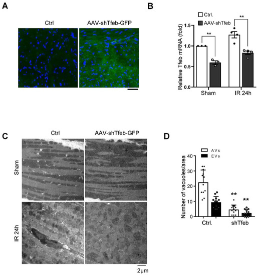 Tfeb-Mediated Transcriptional Regulation of Autophagy Induces Autosis ...