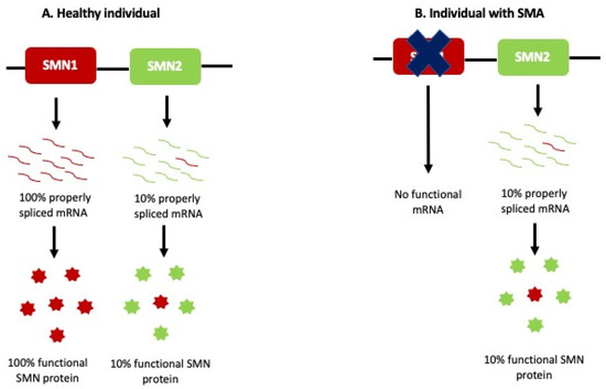 Cells | Free Full-Text | Restoring SMN Expression: An Overview of the ...