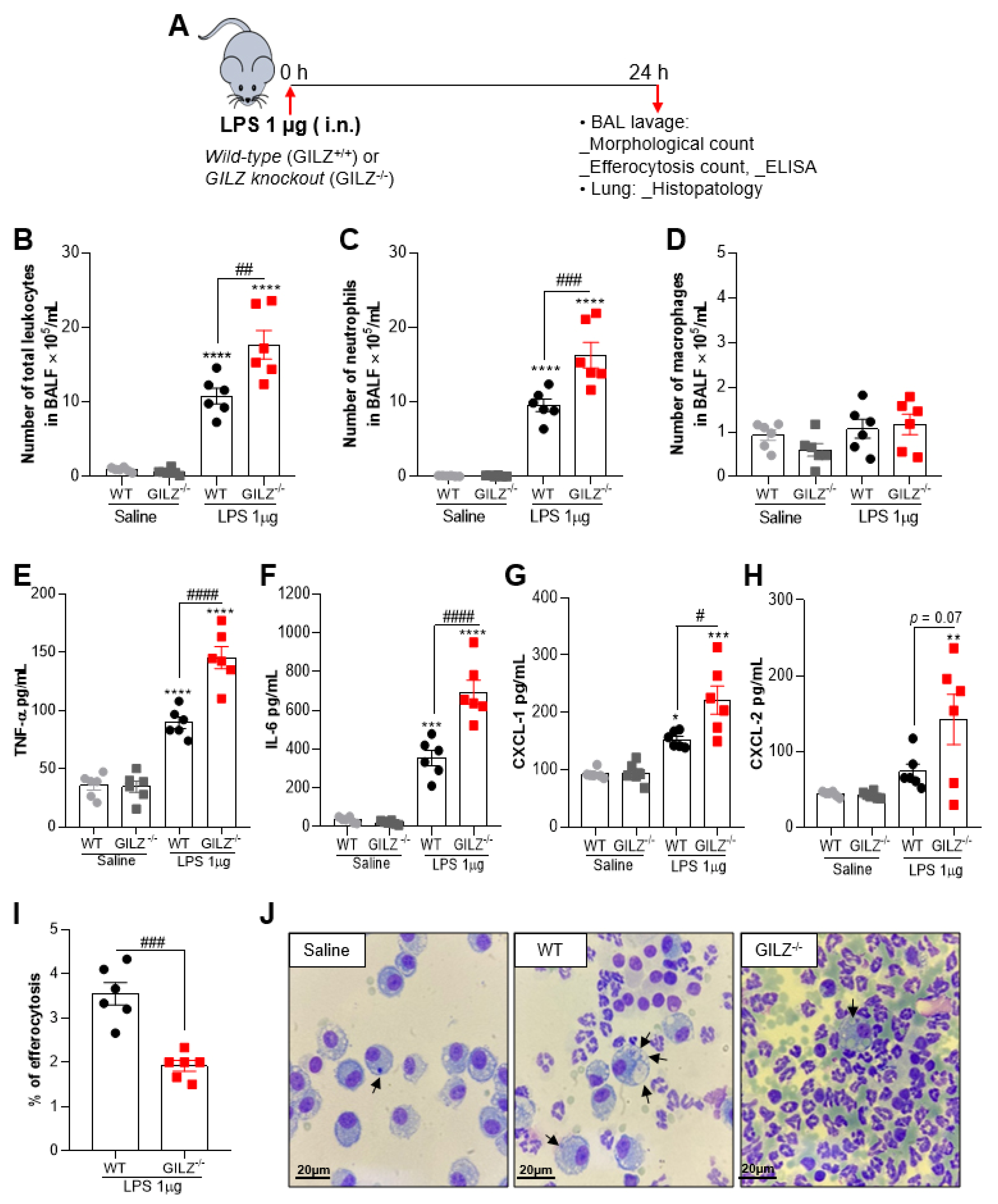 Glucocorticoid-Induced Leucine Zipper Alleviates Lung Inflammation and ...