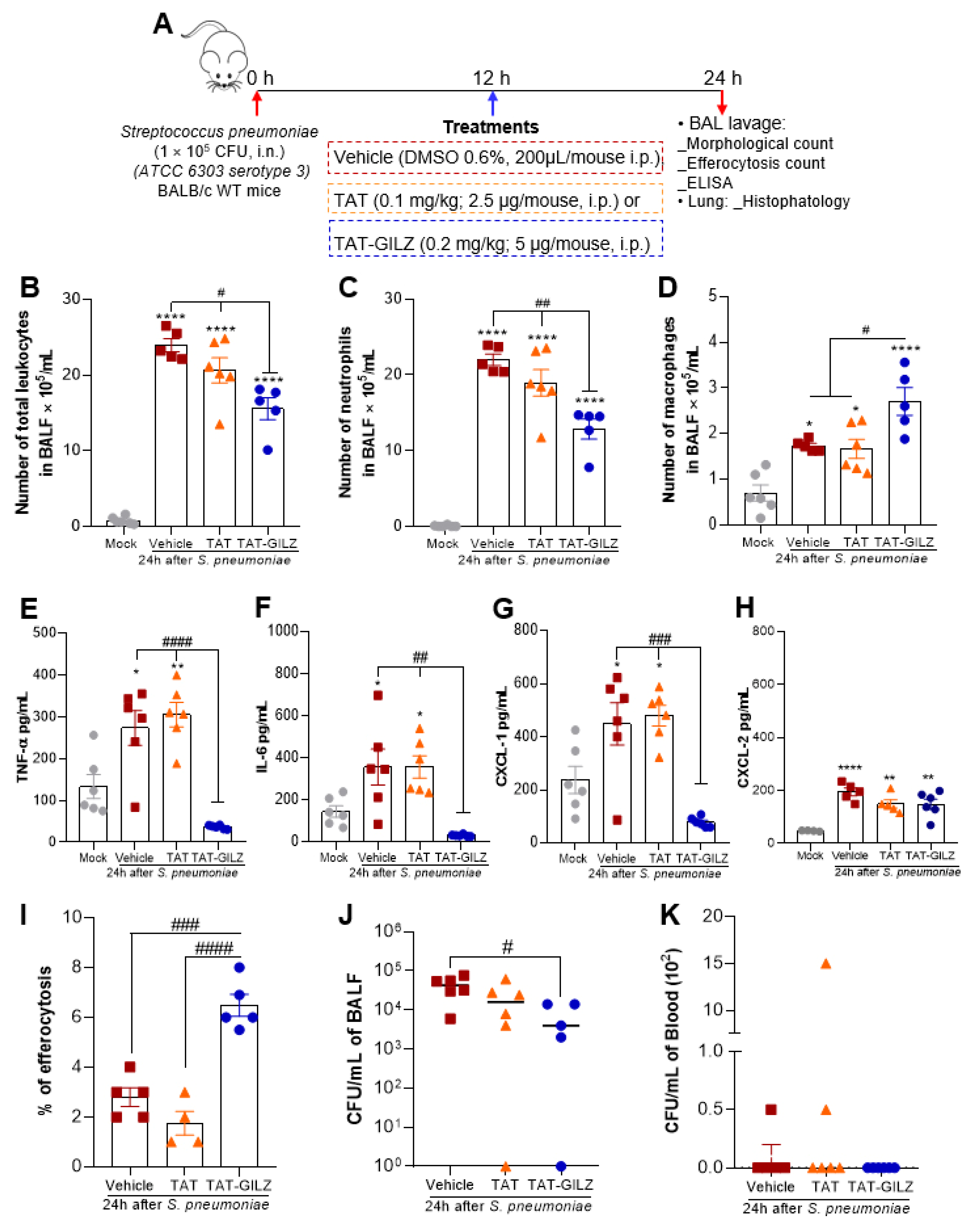 Glucocorticoid-Induced Leucine Zipper Alleviates Lung Inflammation and ...
