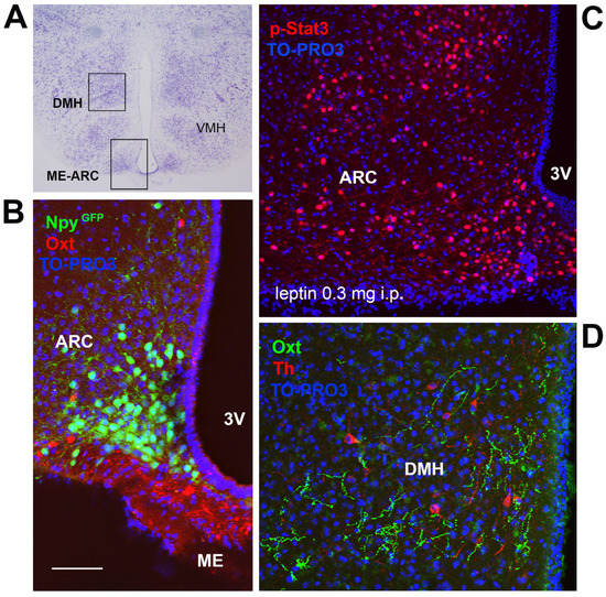 Early Life Stress, Brain Development, and Obesity Risk: Is Oxytocin the ...