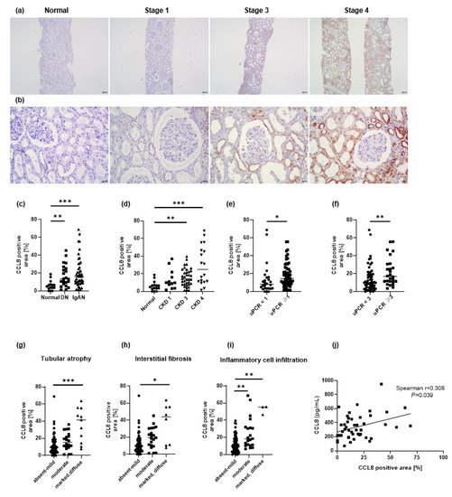 Cells | Free Full-Text | Chemokine (C-C Motif) Ligand 8 and Tubulo ...