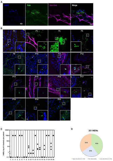 Intratumor Microbiome in Neuroendocrine Neoplasms: A New Partner of ...