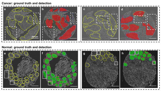 Cells | Free Full-Text | Automatic Colorectal Cancer Screening Using ...