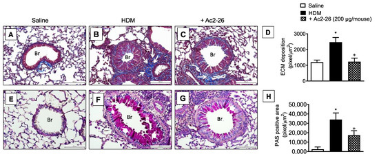 Annexin-A1-Derived Peptide Ac2-26 Suppresses Allergic Airway ...