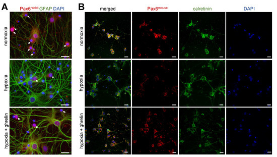 Cells | Special Issue : Induced Impairment of Neurogenesis and Brain ...