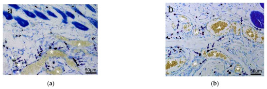 Activation of Subcutaneous Mast Cells in Acupuncture Points Triggers ...