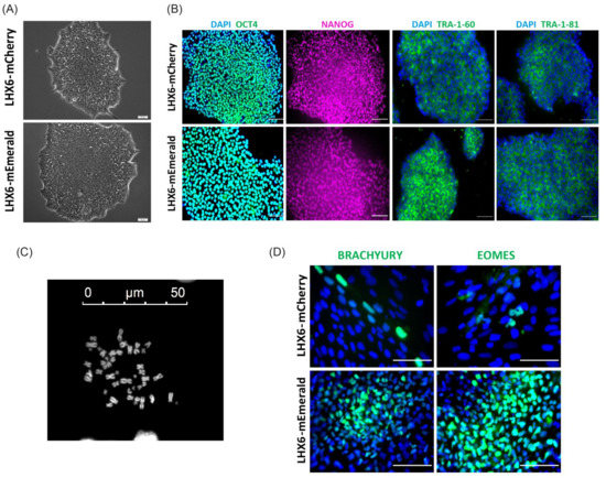 A Novel LHX6 Reporter Cell Line for Tracking Human iPSC-Derived ...