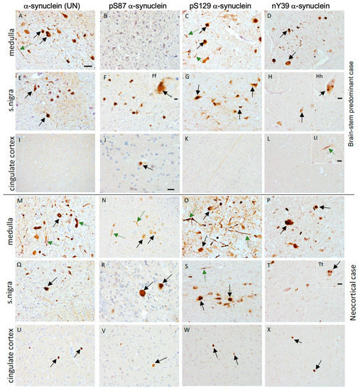 Cells | Free Full-Text | Pathological Relevance of Post-Translationally Modified Alpha-Synuclein ...
