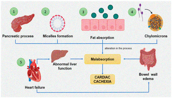 Interconnection between Cardiac Cachexia and Heart Failure—Protective ...