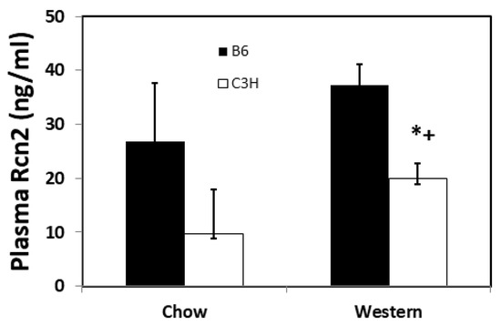 Reticulocalbin 2 as a Potential Biomarker and Therapeutic Target for ...