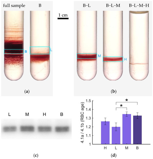 Continuous Percoll Gradient Centrifugation of Erythrocytes—Explanation ...