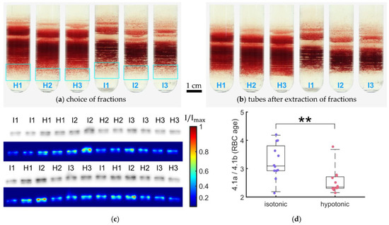Continuous Percoll Gradient Centrifugation of Erythrocytes—Explanation ...