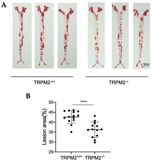 TRPM2 Promotes Atherosclerotic Progression in a Mouse Model of ...