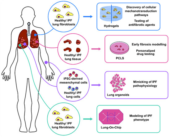 3D In Vitro Models: Novel Insights into Idiopathic Pulmonary Fibrosis ...