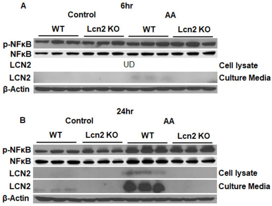 Lipocalin 2 Deficiency Alters Prostaglandin Biosynthesis and mTOR ...