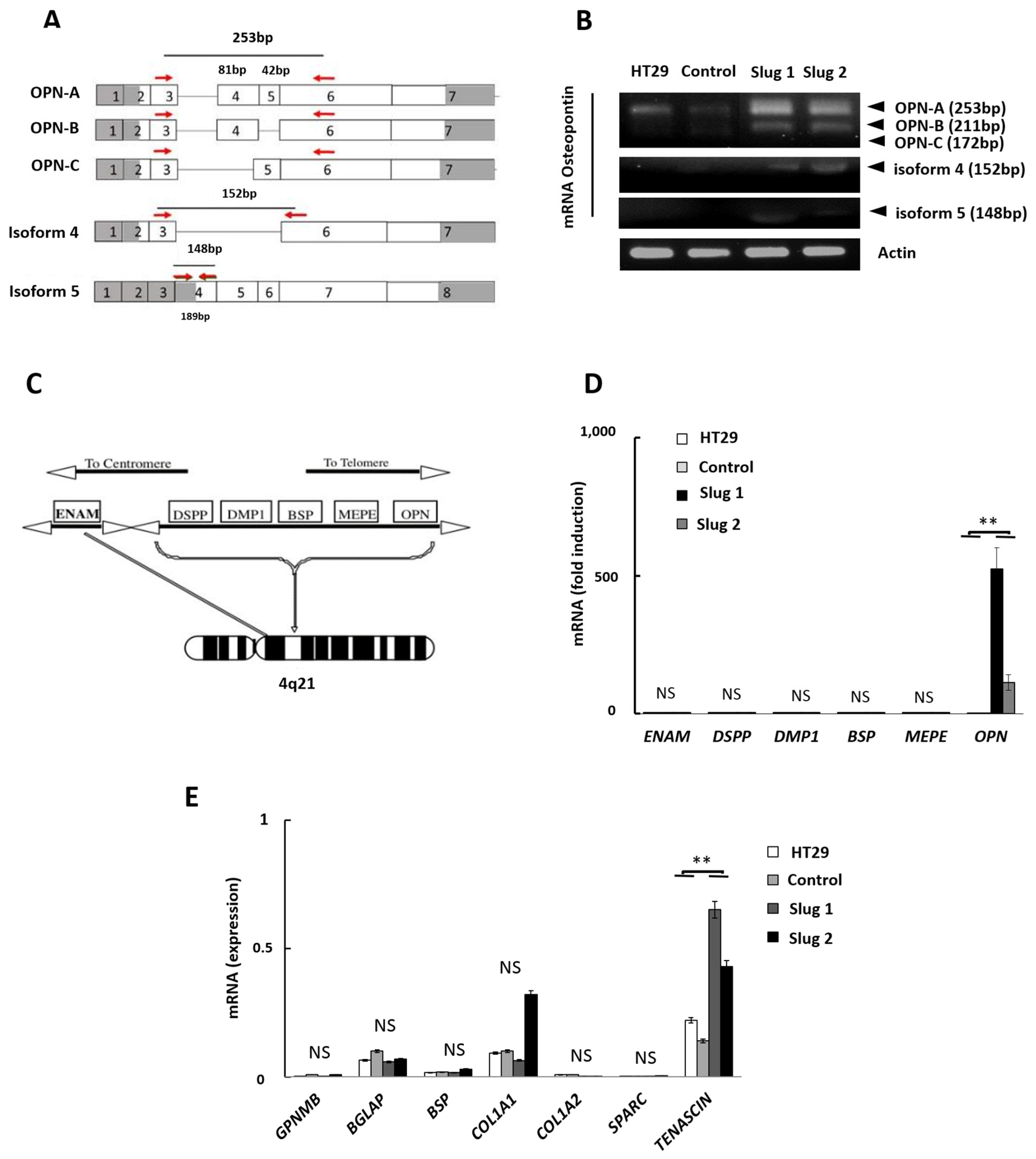Osteopontin (OPN/SPP1), a Mediator of Tumor Progression, Is Regulated ...