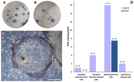 Generating iPSCs with a High-Efficient, Non-Invasive Method—An Improved ...