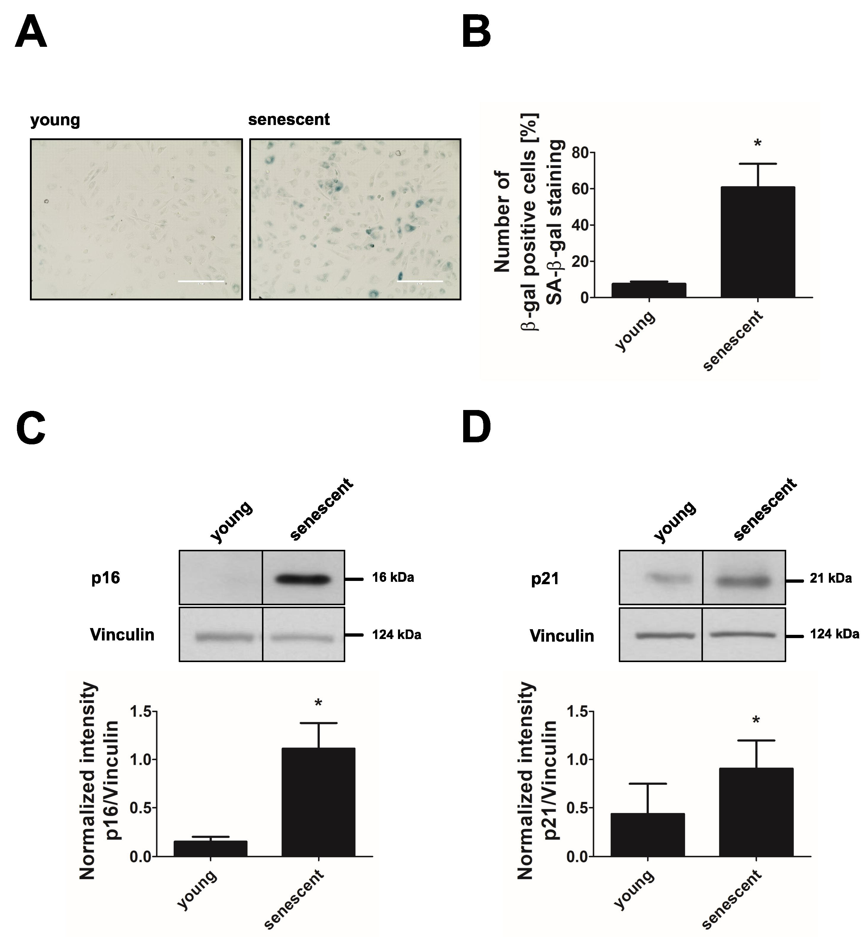Oxidative Glucose Metabolism Promotes Senescence in Vascular ...