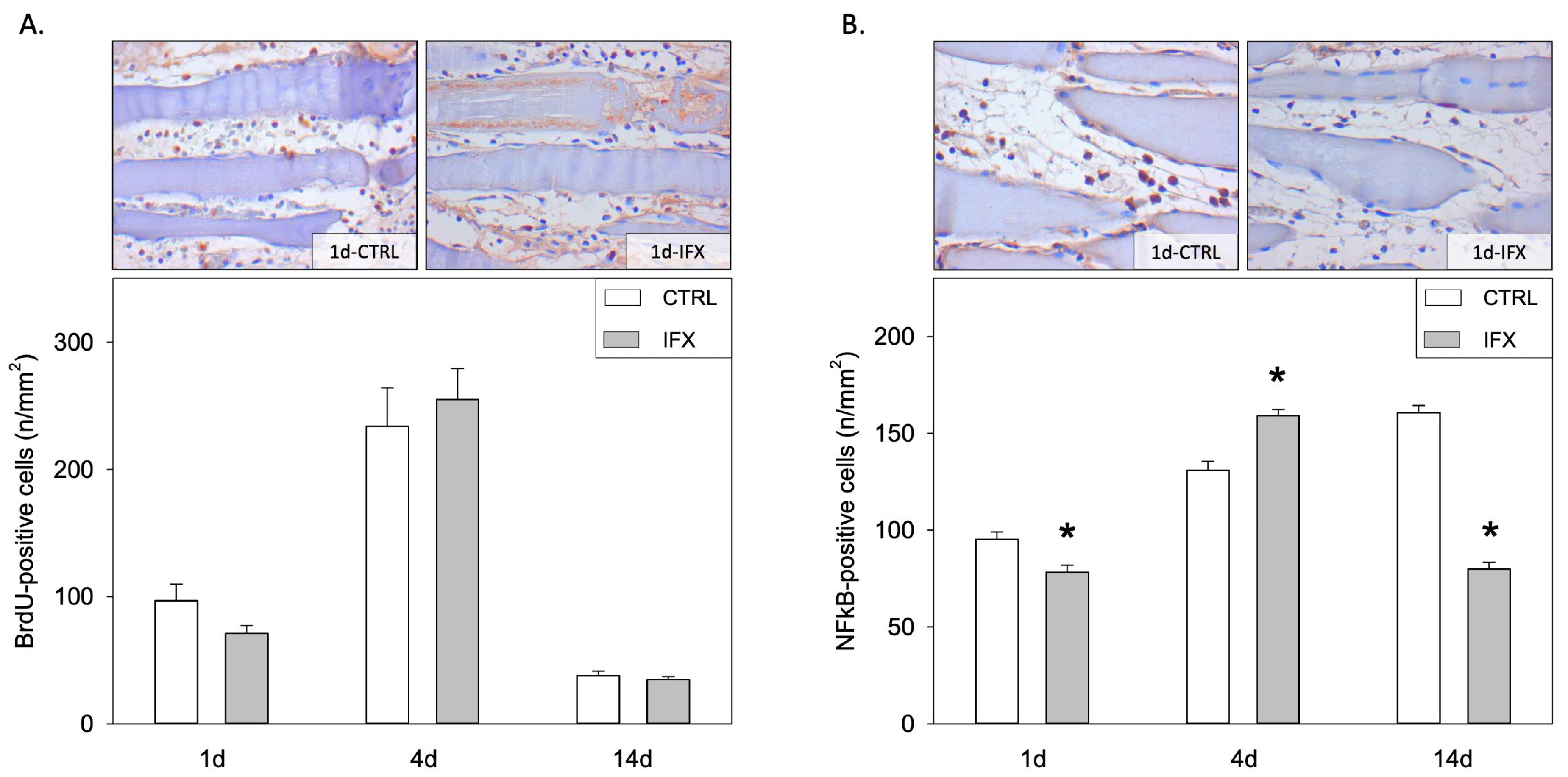 Cells | Free Full-Text | Inhibition of TNF-α Restores Muscle Force ...
