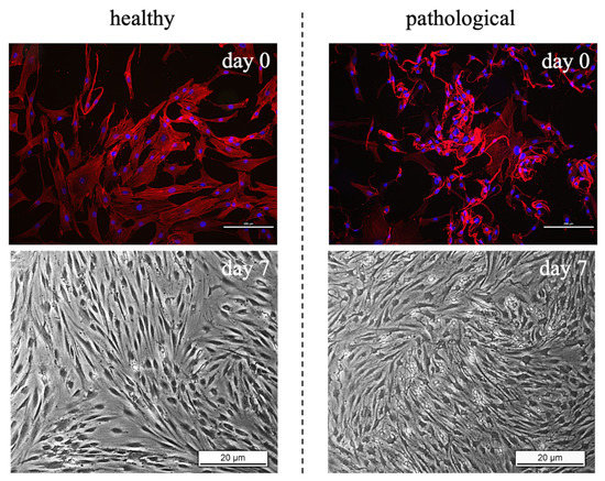 Stem Cells from Healthy and Tendinopathic Human Tendons: Morphology ...