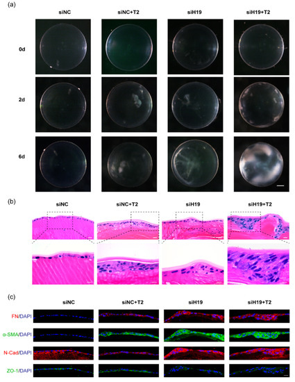 Long Non-Coding RNA H19 Prevents Lens Fibrosis through Maintaining Lens ...