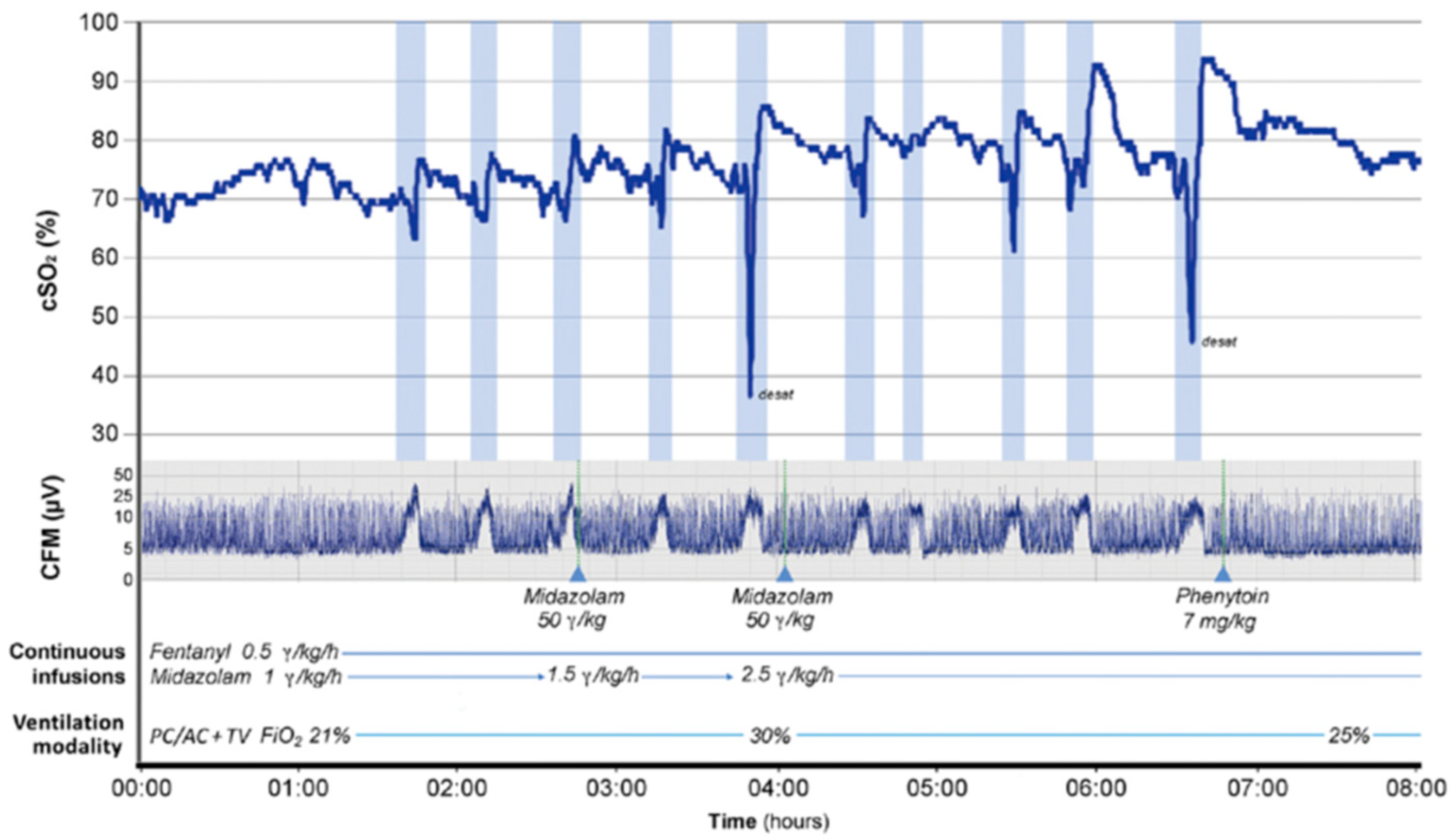Optical Monitoring in Neonatal Seizures