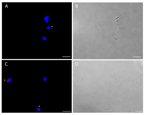 Cellular and Molecular Mechanisms of In Vivo and In Vitro SARS-CoV-2 ...