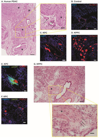 Genetic Mouse Models to Study Pancreatic Cancer-Induced Pain and ...