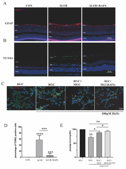 Autophagy in Rat Müller Glial Cells Is Modulated by the Sirtuin 4/AMPK ...