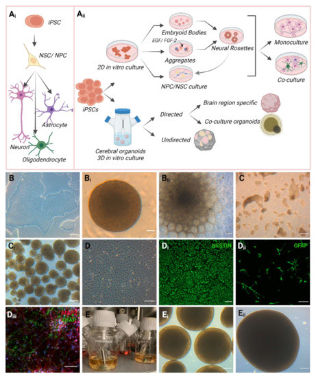 Bilirubin-Induced Neurological Damage: Current and Emerging iPSC-Derived Brain Organoid Models