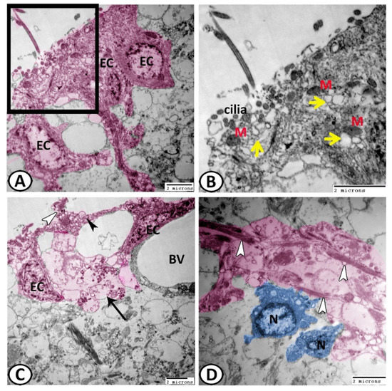 Ependymal and Neural Stem Cells of Adult Molly Fish (Poecilia sphenops ...