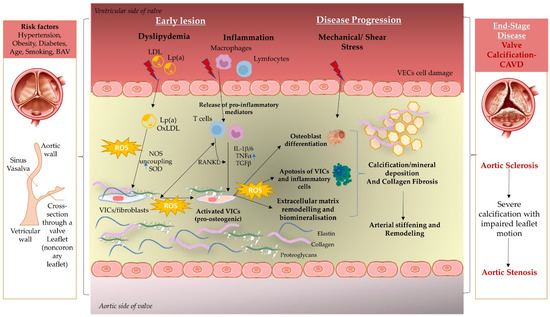 Contribution of Oxidative Stress (OS) in Calcific Aortic Valve Disease ...
