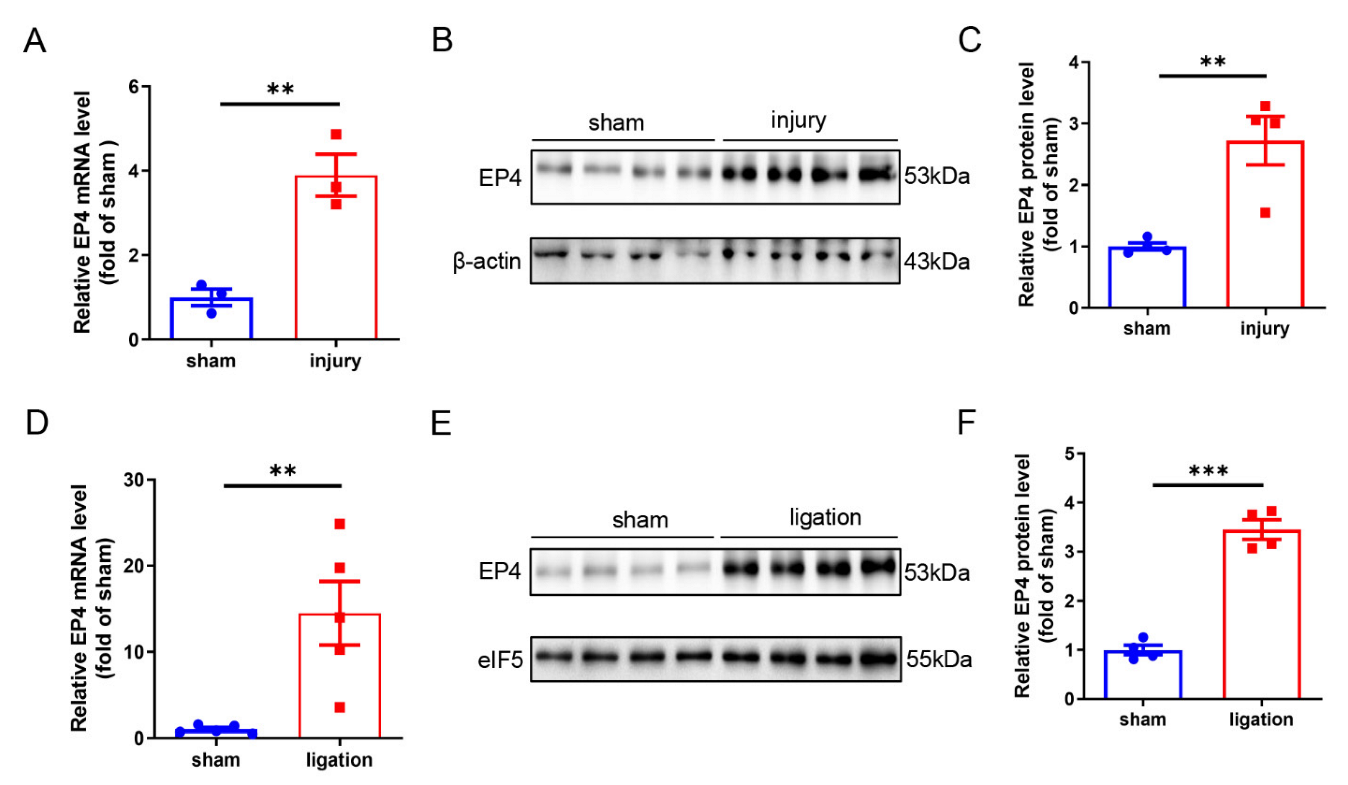 The Prostaglandin E2 Receptor EP4 Promotes Vascular Neointimal ...