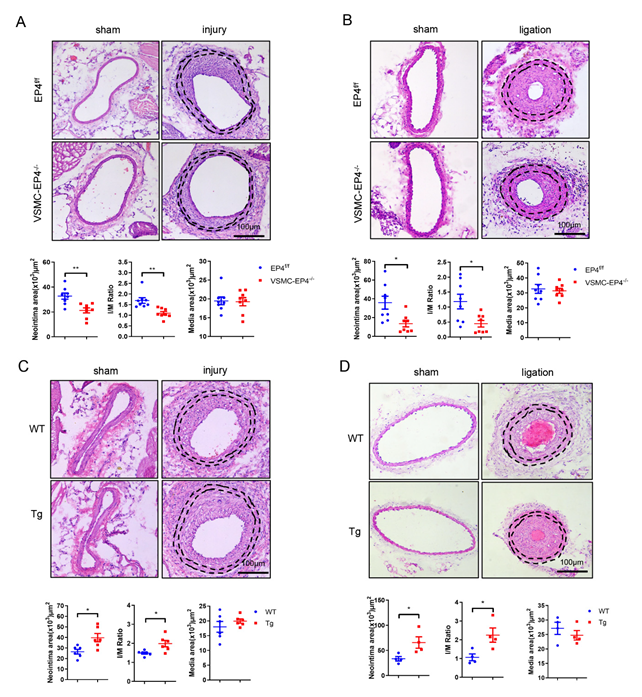 The Prostaglandin E2 Receptor EP4 Promotes Vascular Neointimal ...