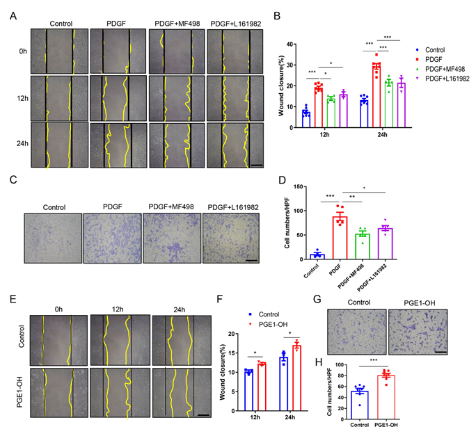 The Prostaglandin E2 Receptor EP4 Promotes Vascular Neointimal ...
