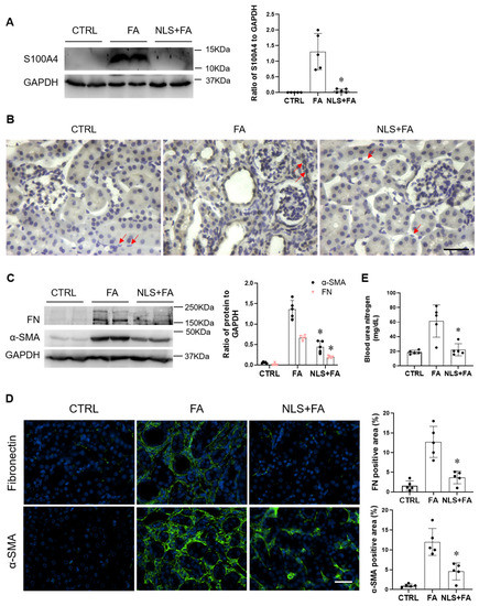 Pharmacological Inhibition of S100A4 Attenuates Fibroblast Activation ...