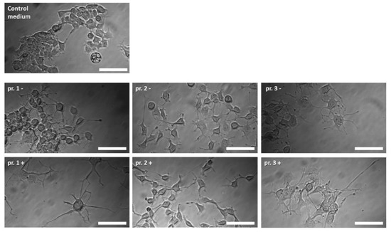 Peripheral Nerve Regeneration–Adipose-Tissue-Derived Stem Cells ...