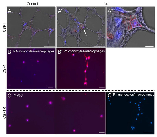 Cells | Free Full-Text | Macrophage-Secreted CSF1 Transmits a Calorie ...