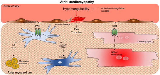 The Complex Relation between Atrial Cardiomyopathy and Thrombogenesis