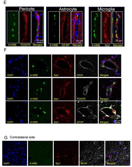 Cells | Free Full-Text | Treatment of Marmoset Intracerebral Hemorrhage ...